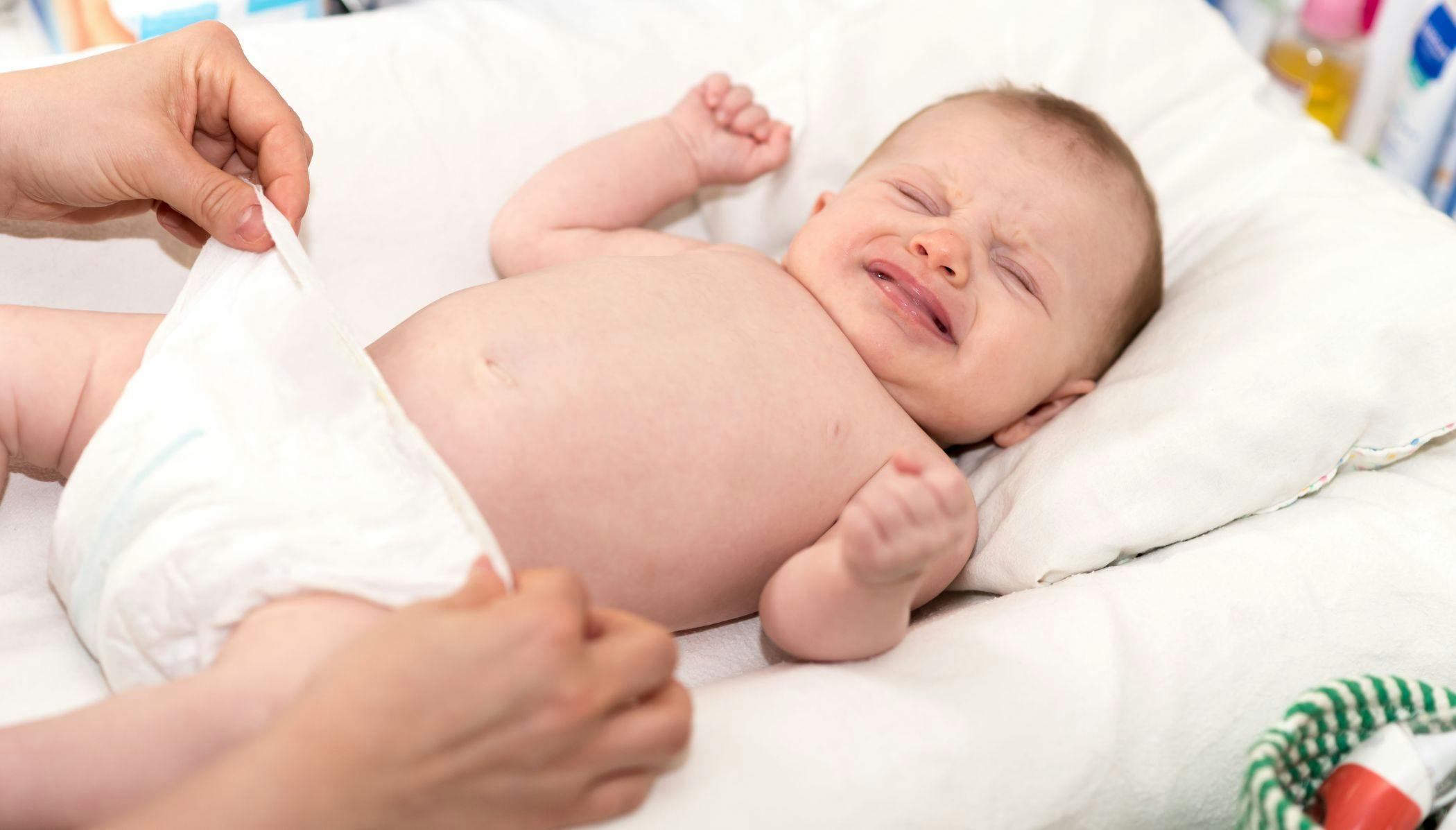 Balanitis in babies: Causes, symptoms, and treatment