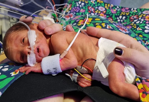 Premature birth story: '2lb 3oz baby fought his life'