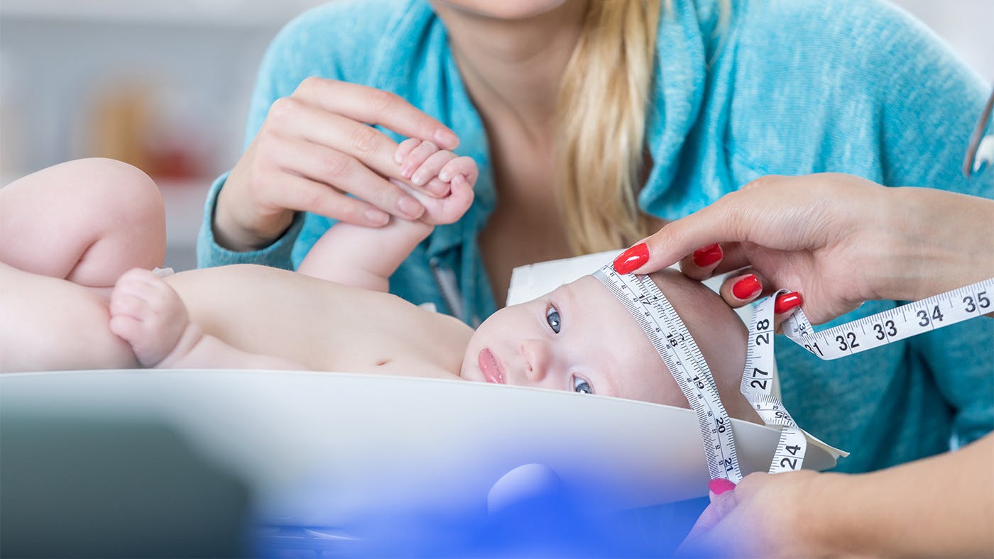 Hydrocephalus in babies: one mum's story