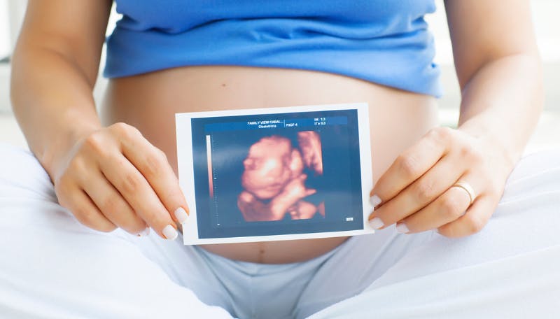 What is a 5D Ultrasound and how are they different?