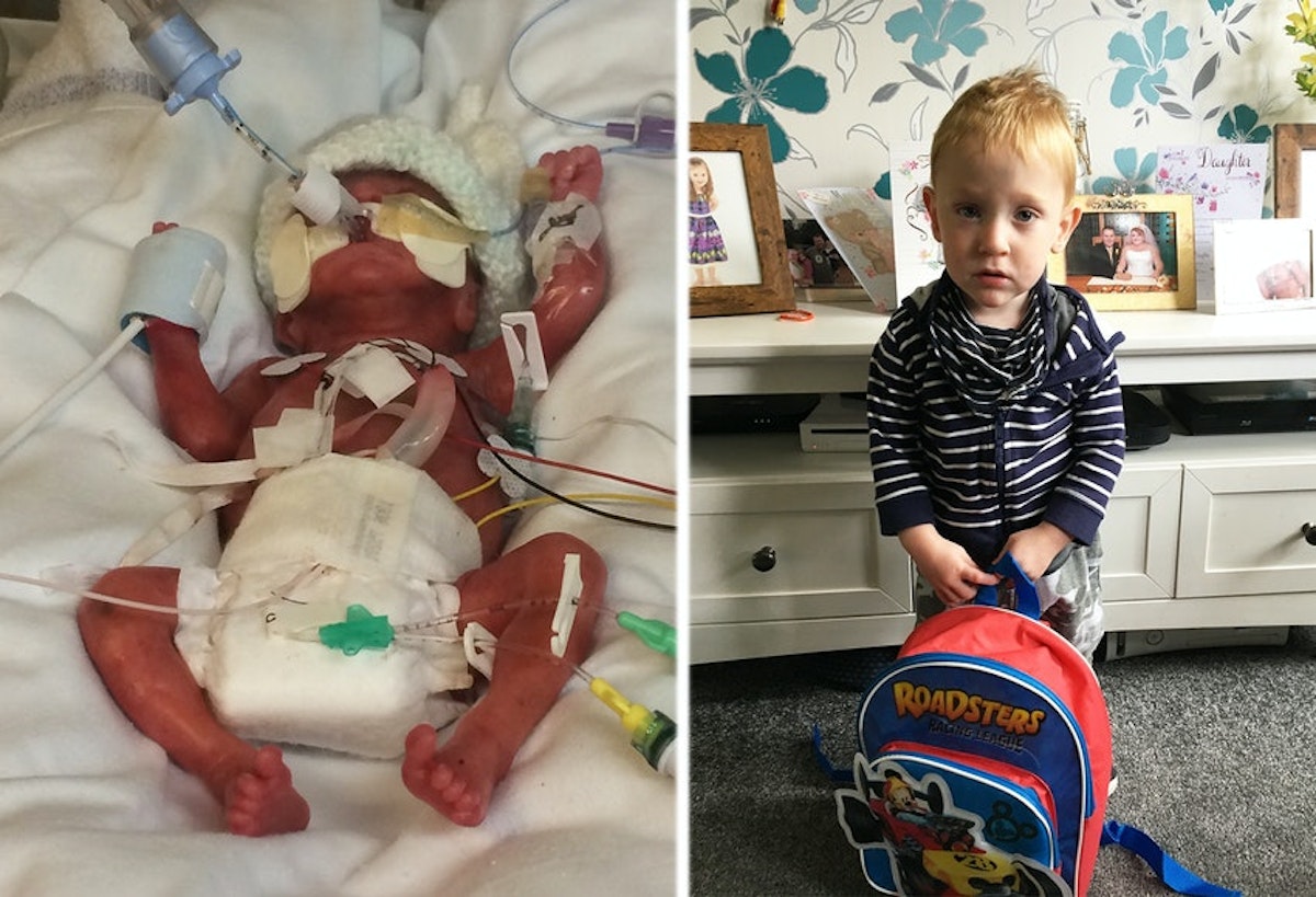 Premature baby care: Support, guidance and advice from real mums