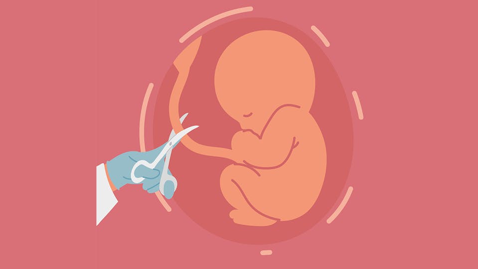 Umbilical Cord Cutting Everything You Need To Know Pregnancy Umbilical Cord Cutting Everything You Need To Know Pregnancy