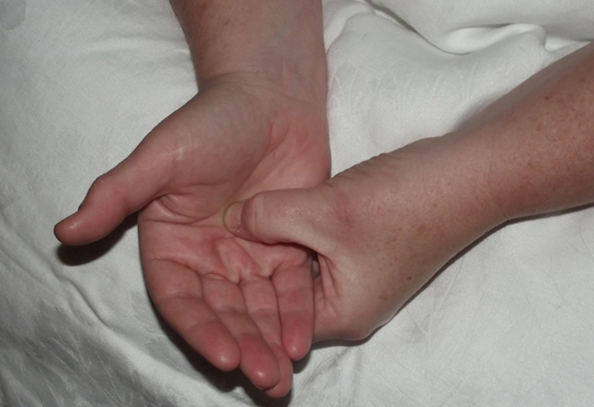 Could reflexology relieve your TTC stress?