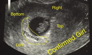 Ramzi Theory: what is it and is it accurate?