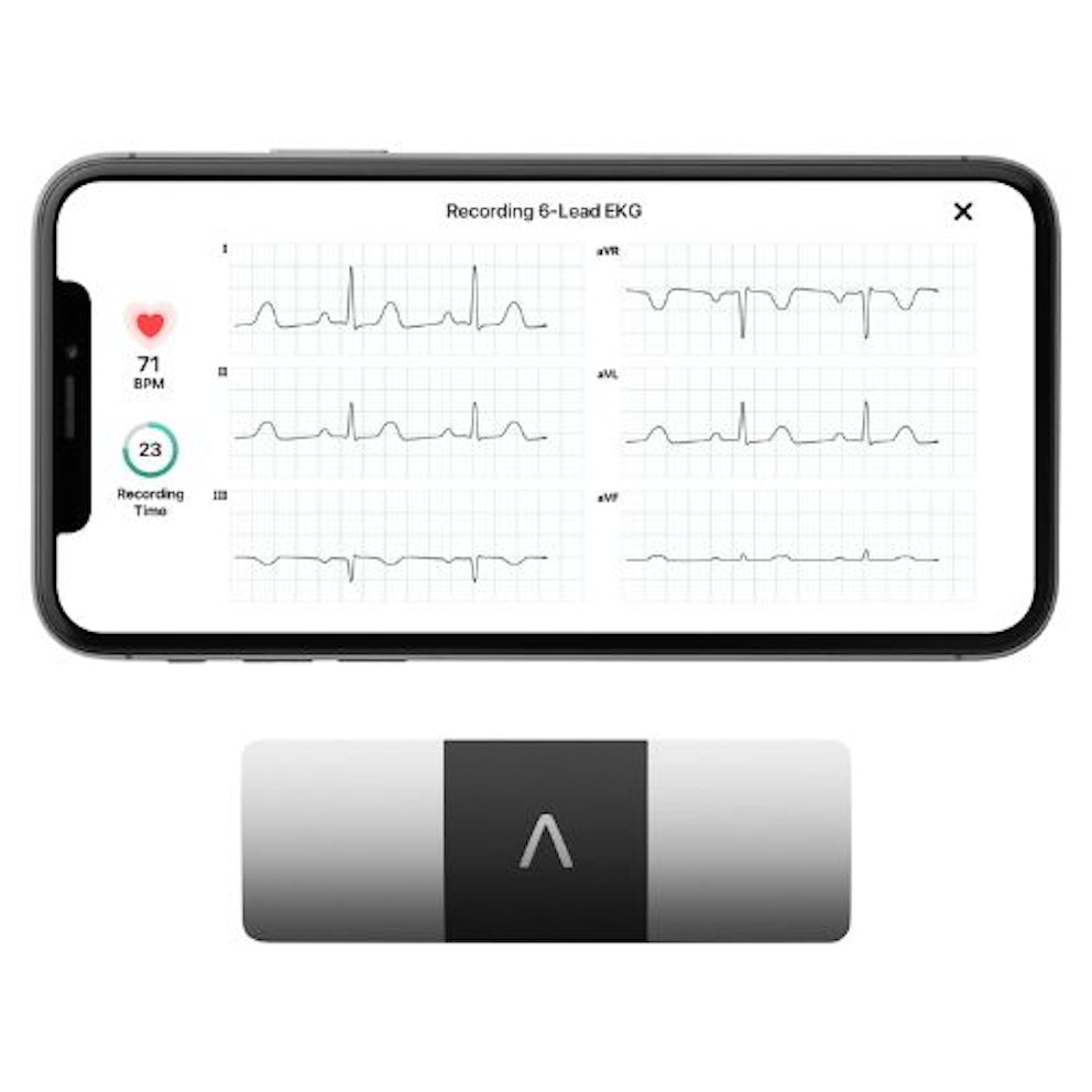 Best home ECG monitor to help monitor your heart health