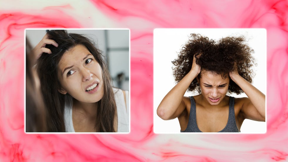 How to get rid of dandruff: the best tips, tricks and advice revealed