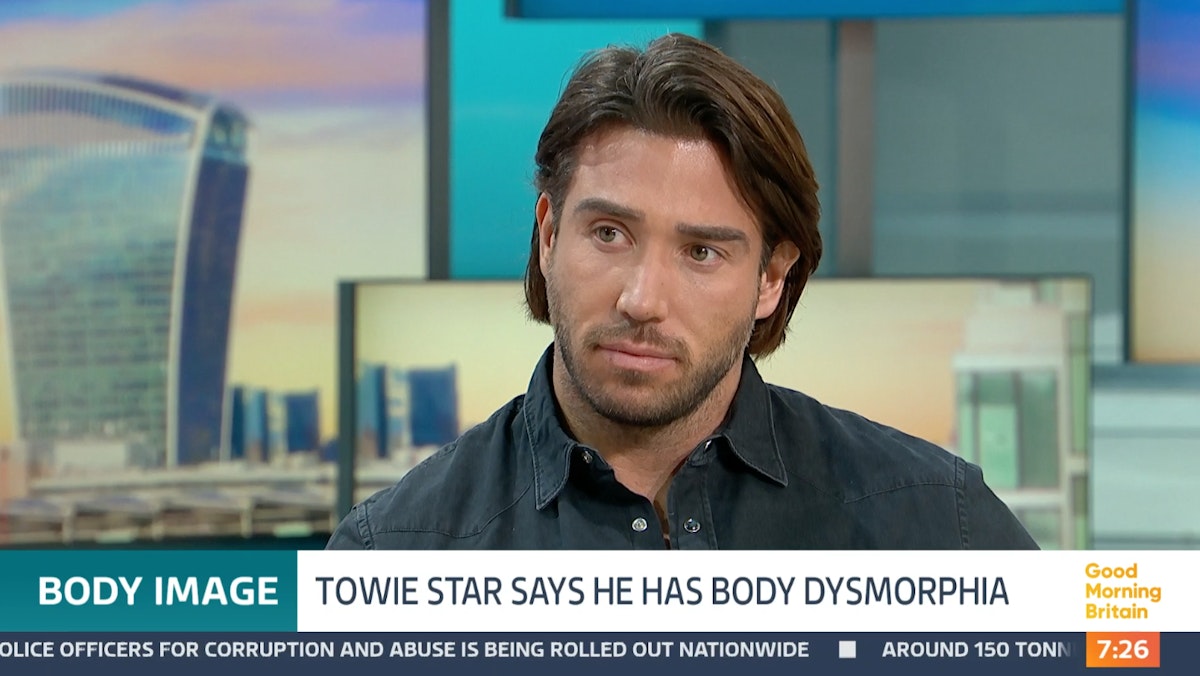 TOWIE's James Lock talks about getting 'carried away' with cosmetic ...