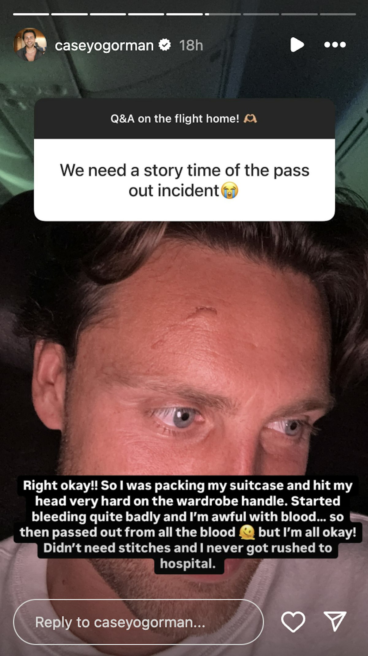 Love Island All Star PASSED OUT in the villa in unaired scenes