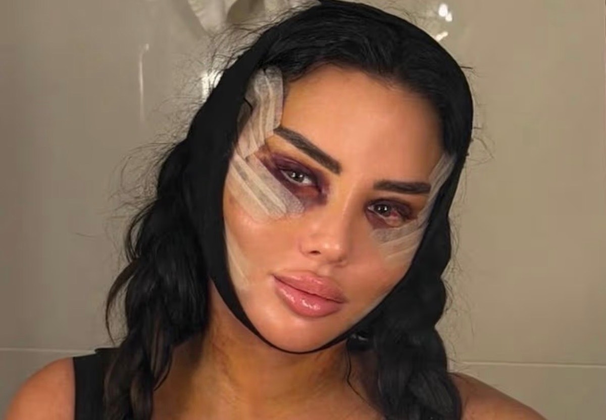 New trend has left reality TV star disfigured and in agony
