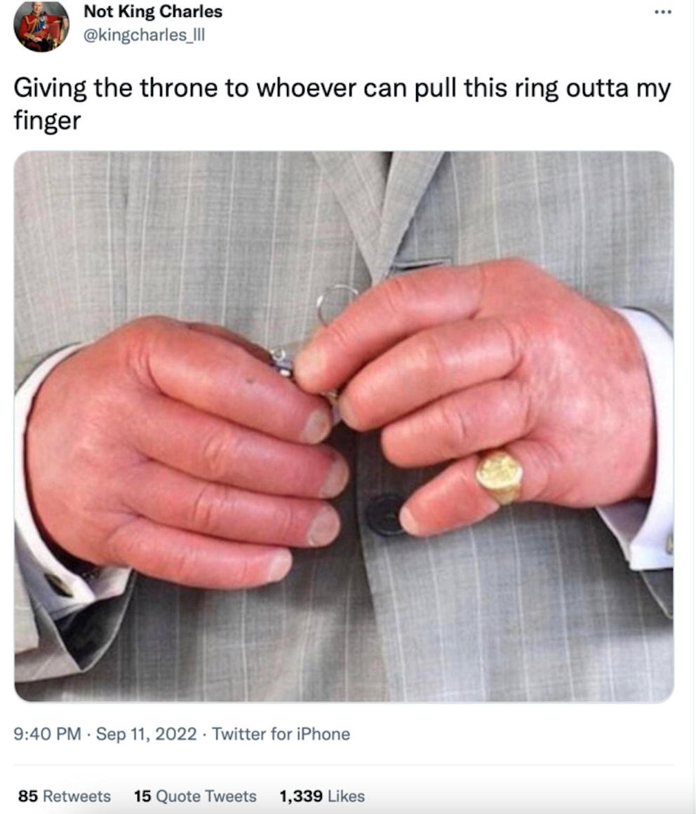 Here’s Why King Charles Fingers Are So Swollen