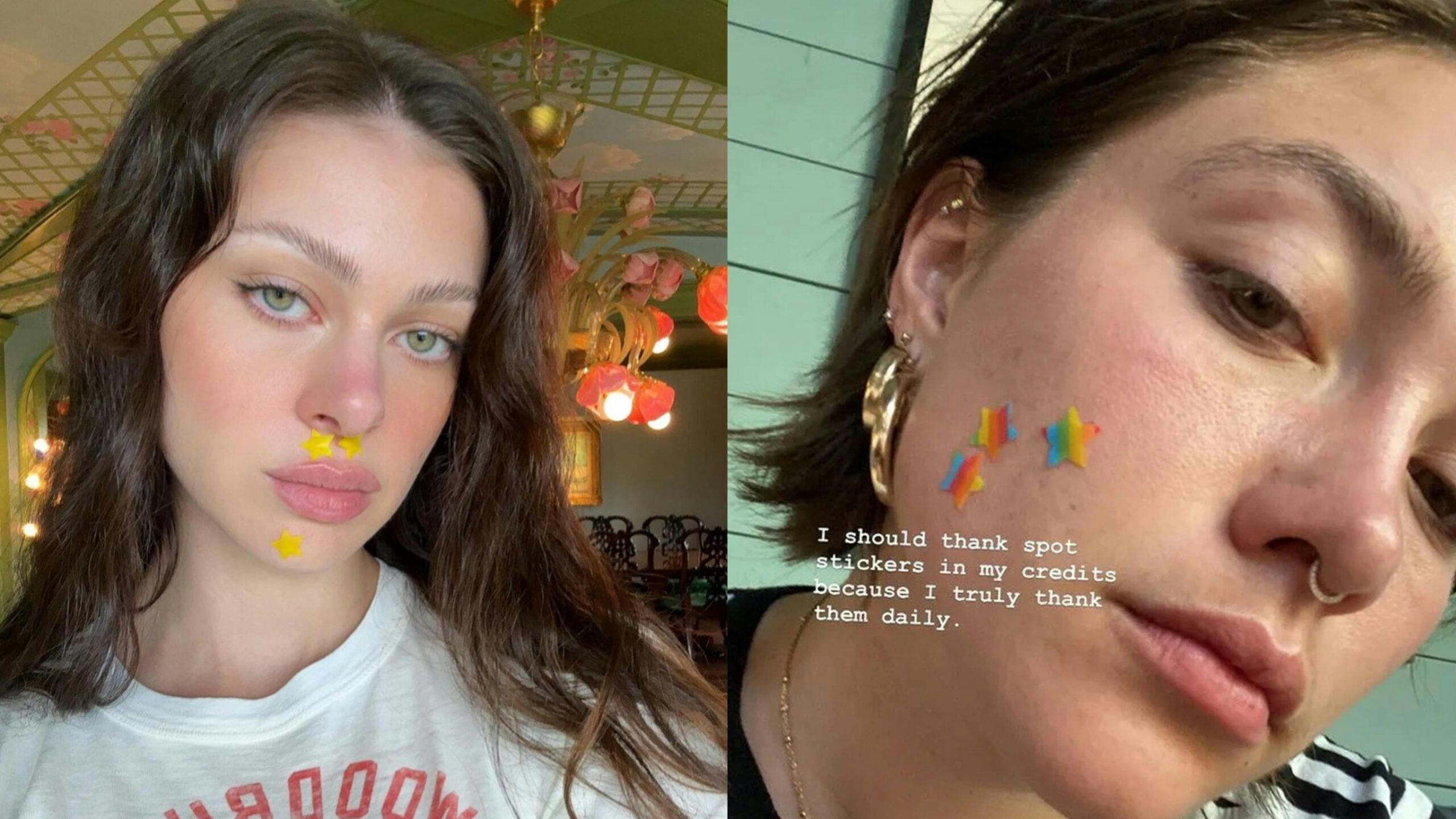 These Celebrity-Approved Pimple Patches Claim To ‘Shrink Spots Overnight