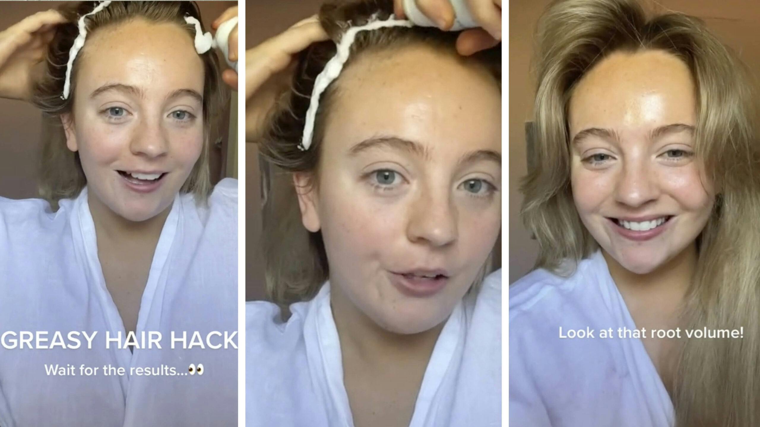 Greasy Hair? TikTok Suggests You Try Salicylic Acid.