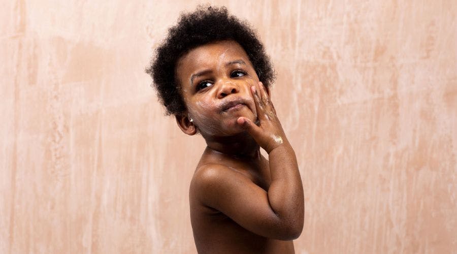 Balmonds Skincare: The Best Balm For Baby Eczema