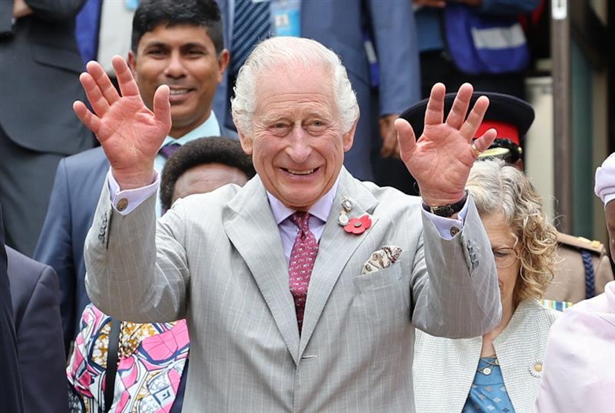 Why Are King Charles' Fingers So Swollen?