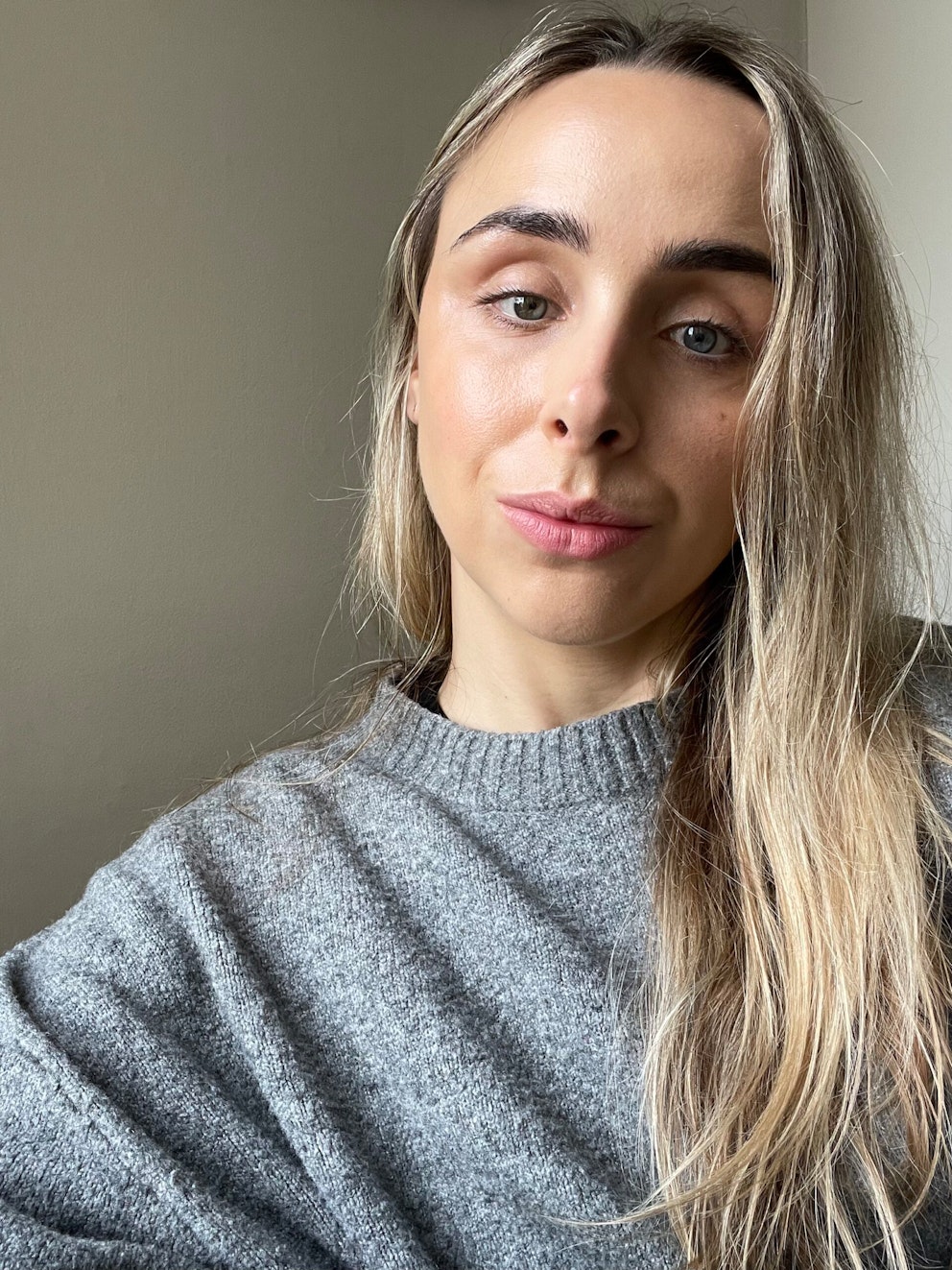 What Is Perioral Dermatitis And How Can You Treat It?