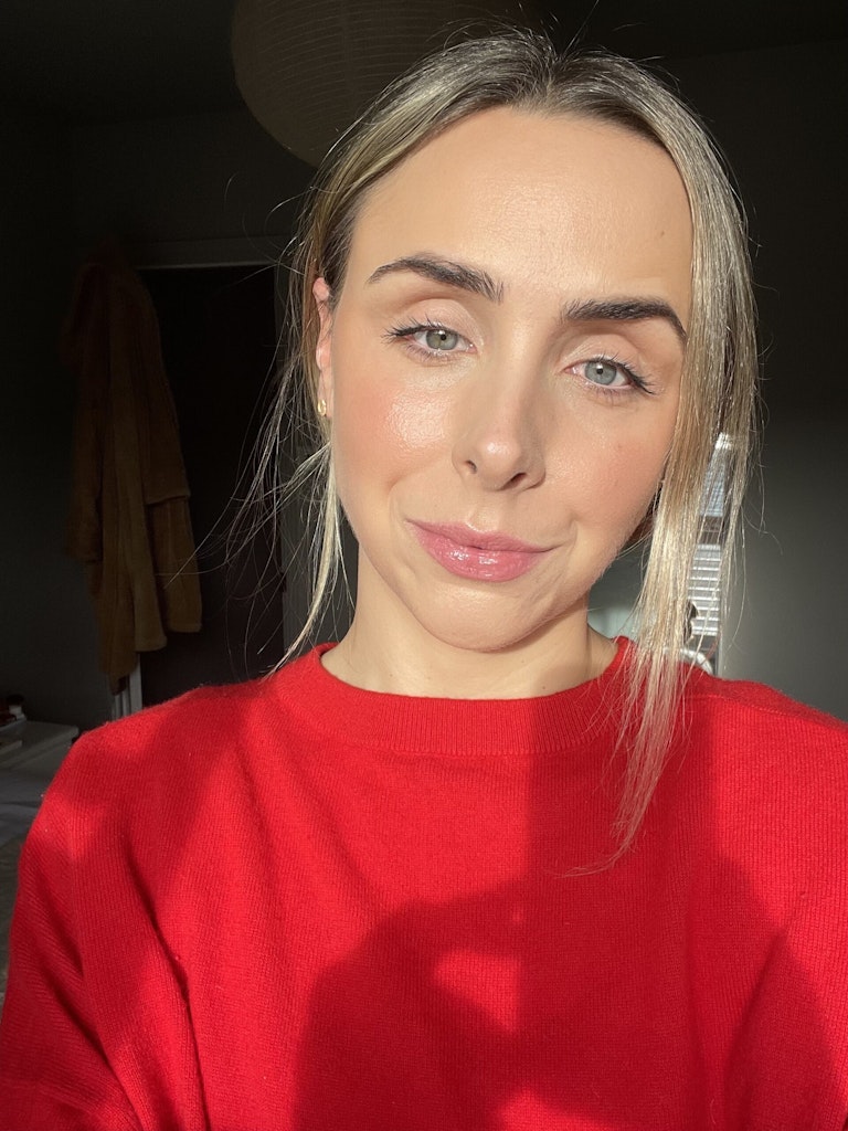 What Is Perioral Dermatitis And How Can You Treat It?