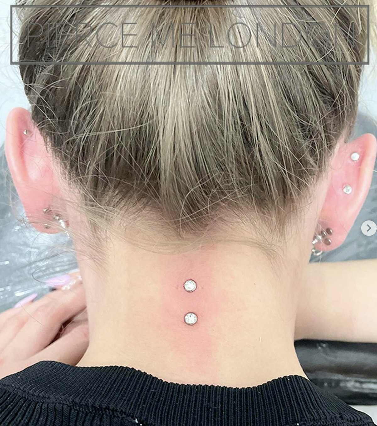 Dermal Piercing: Everything You Need To Know