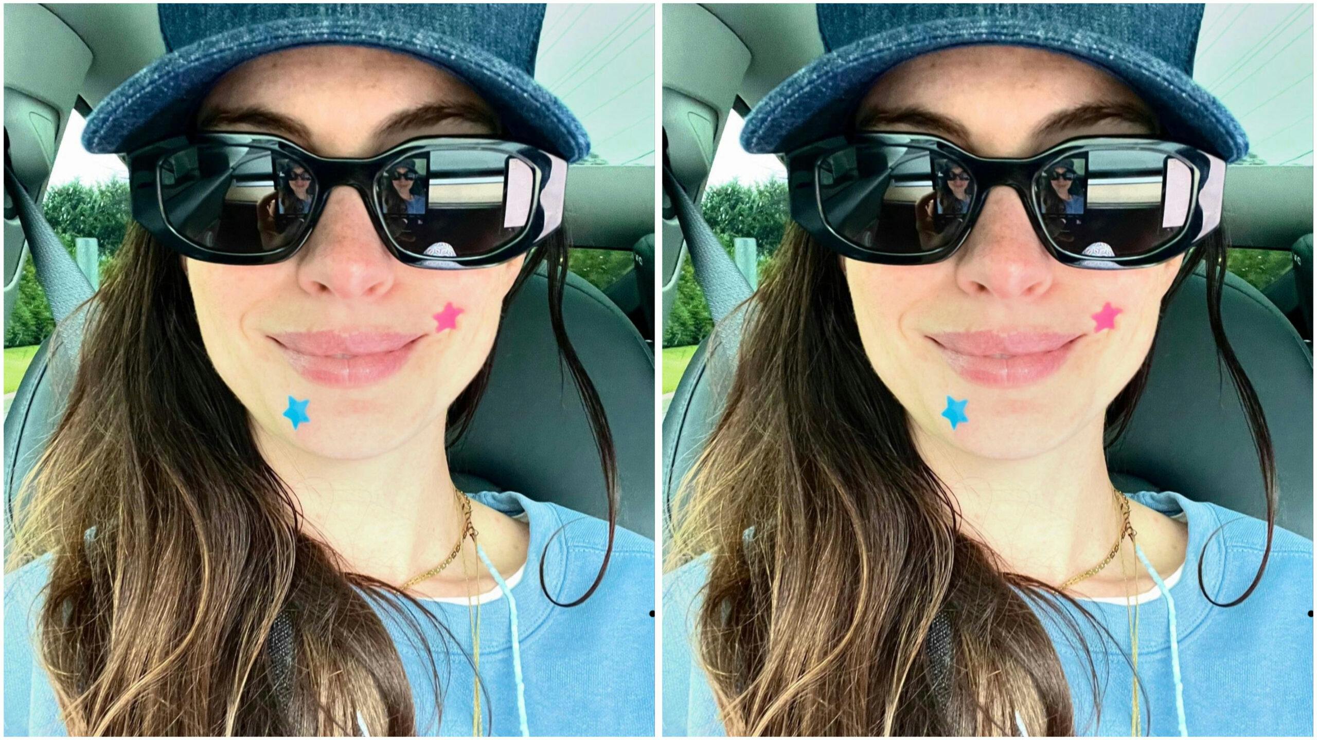 Anne Hathaway Wears These Viral Pimple Patches