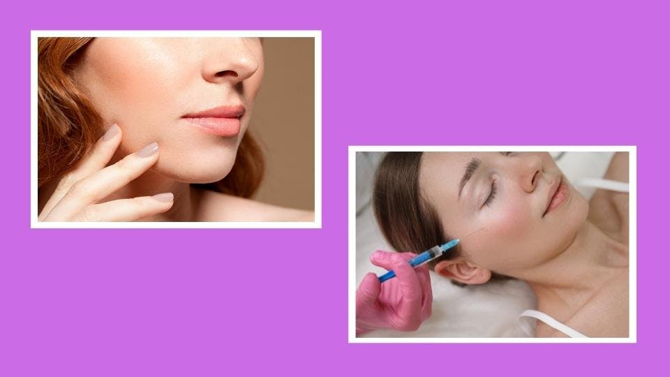 Cheek Fillers Everything You Need To Know Hair And Beauty Heat