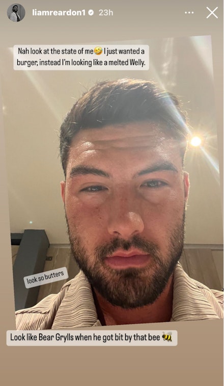 Love Island’s Liam Reardon shows off ‘butters’ snaps and – honestly ...