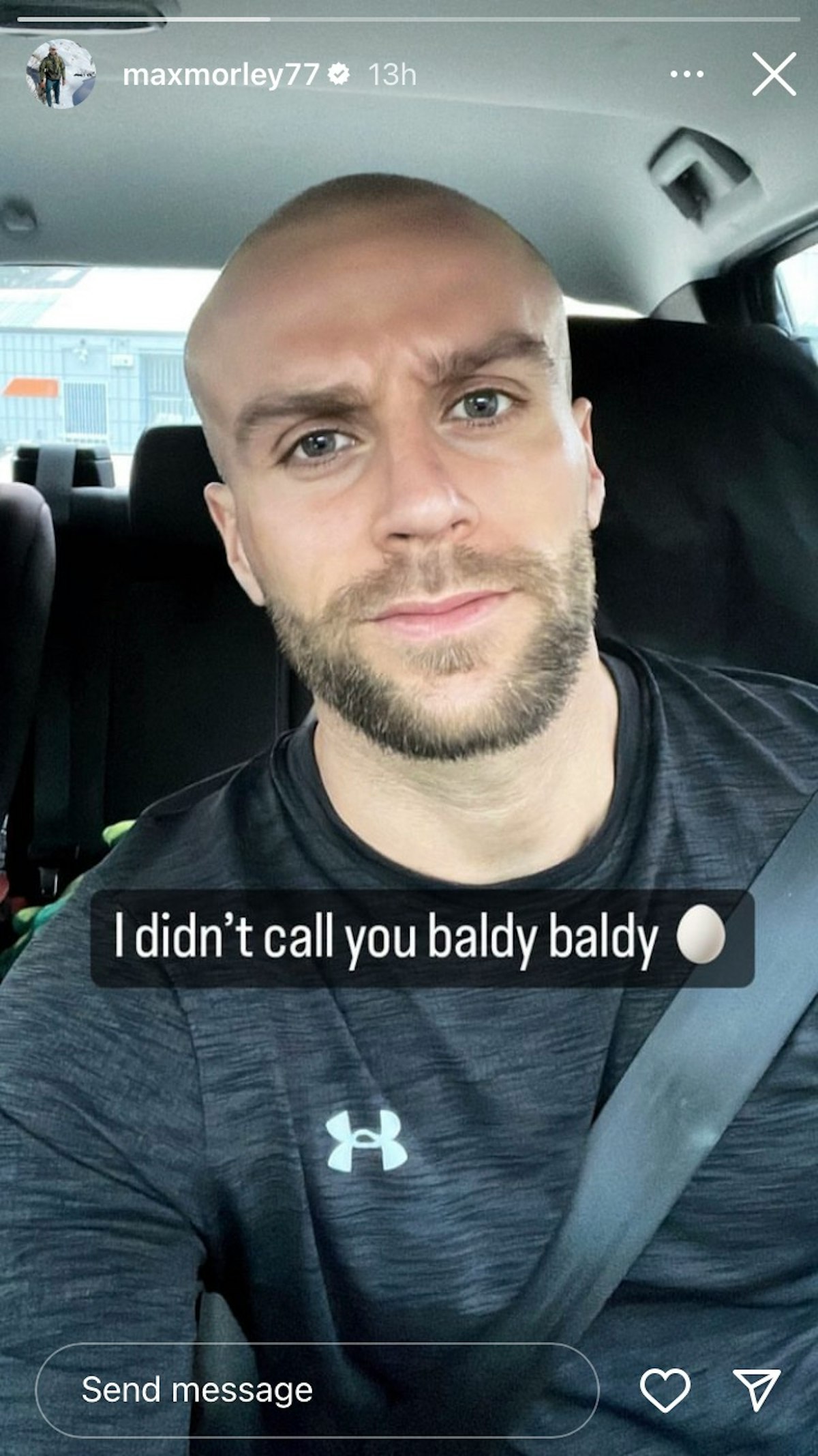 Love Island winner Max Morley shows off bald hair transformation ...