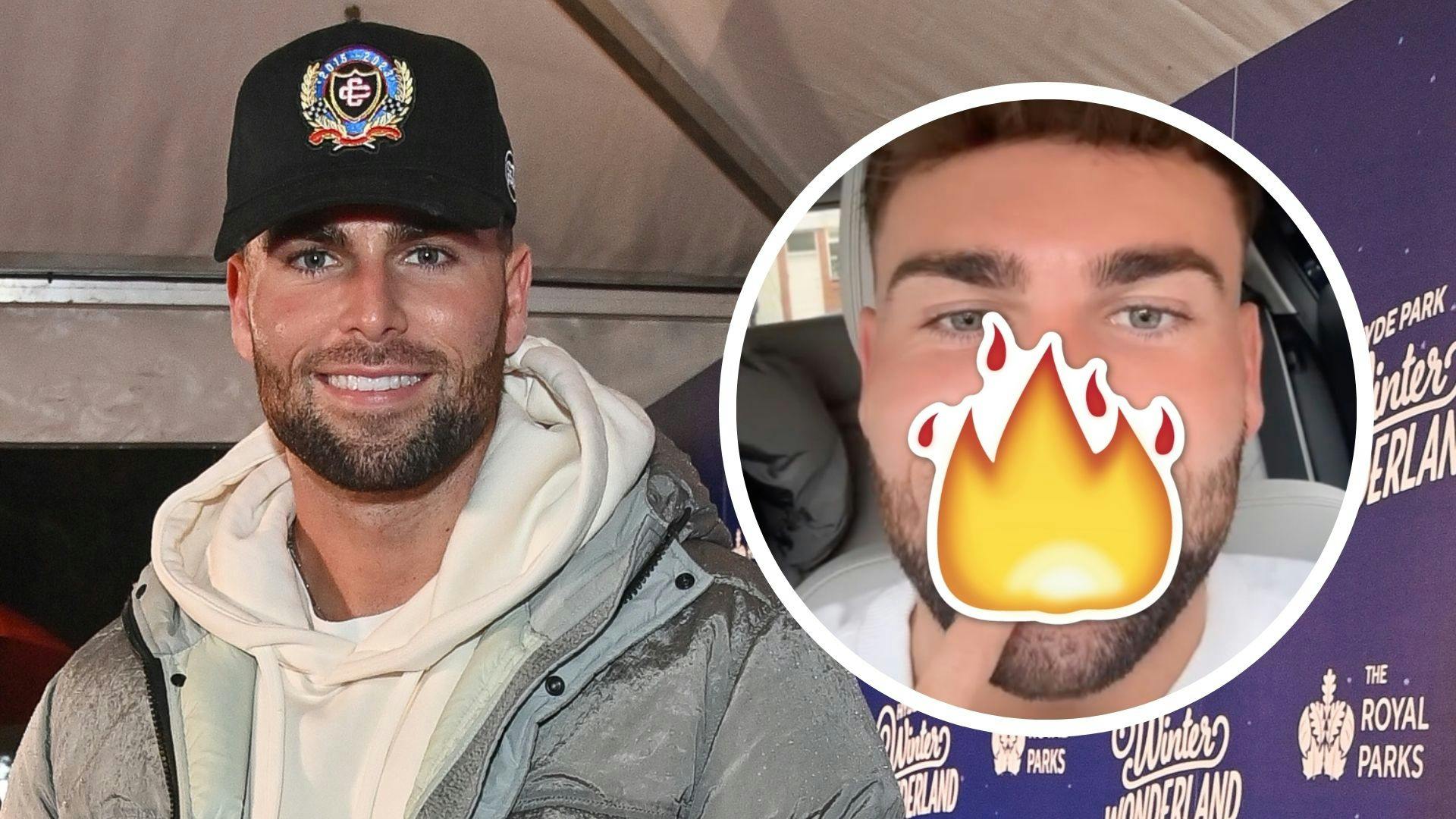 Love Island's Tom Clare unveils teeth transformation and WOW