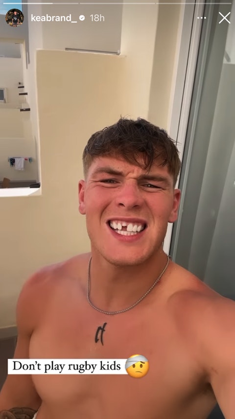 Love Island's Keanan Brand issues warning as he loses a tooth