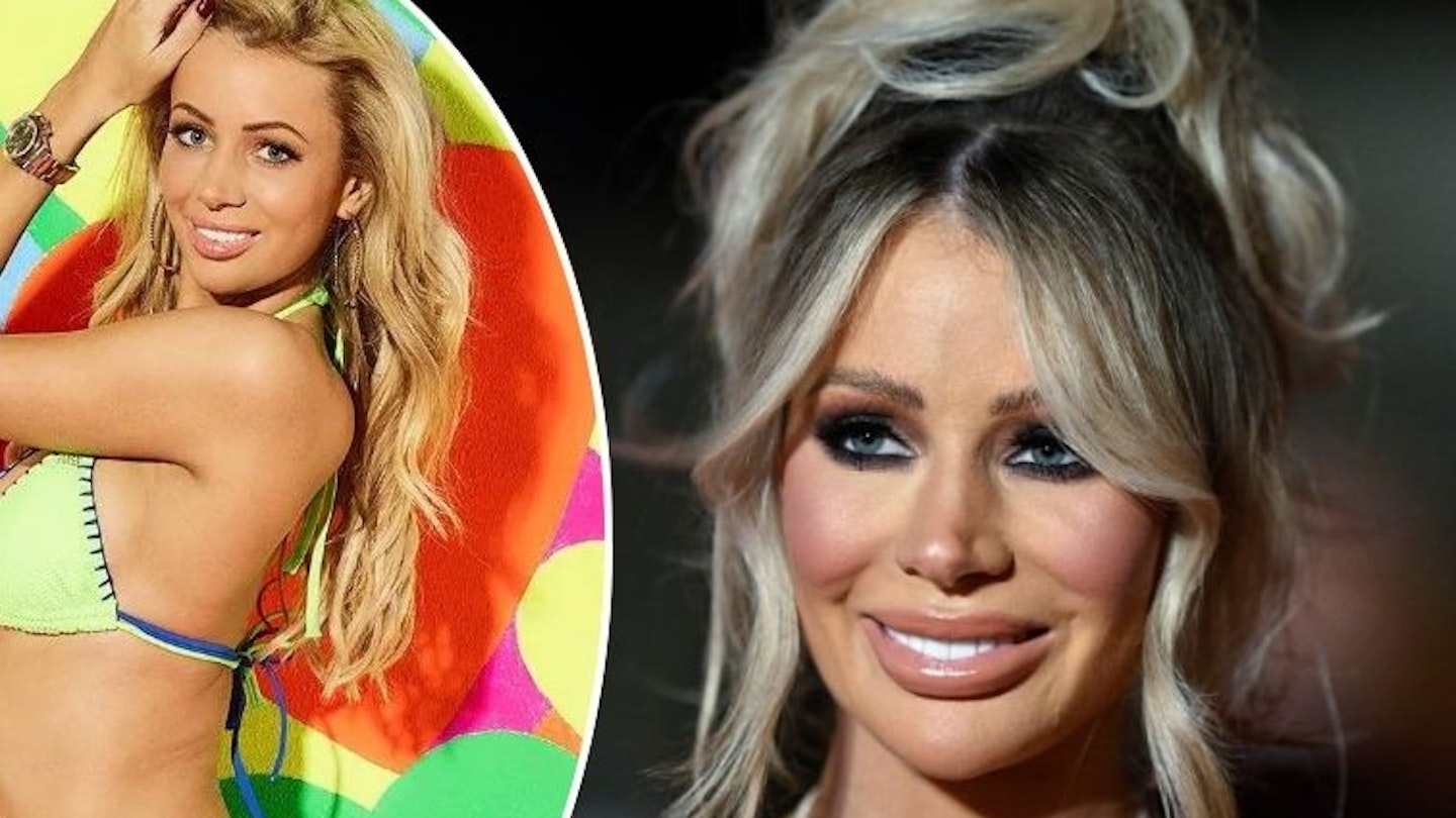 Olivia Attwood Reveals Why Love Island Producers Should Apologise To Her