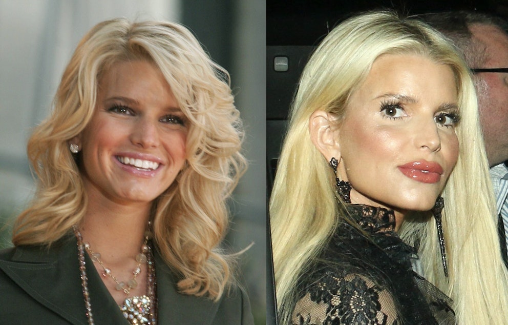 Celebs who had surgery and pretended nothing happened to their face