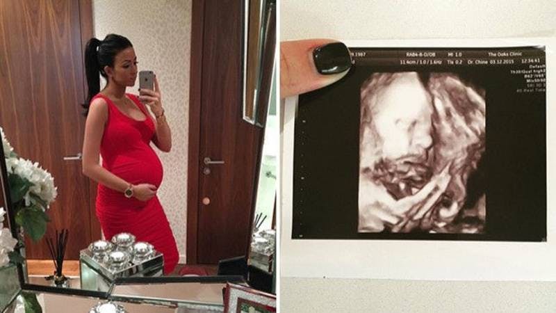 TOWIE’s Cara Kilbey gives birth to rainbow baby: Click for more