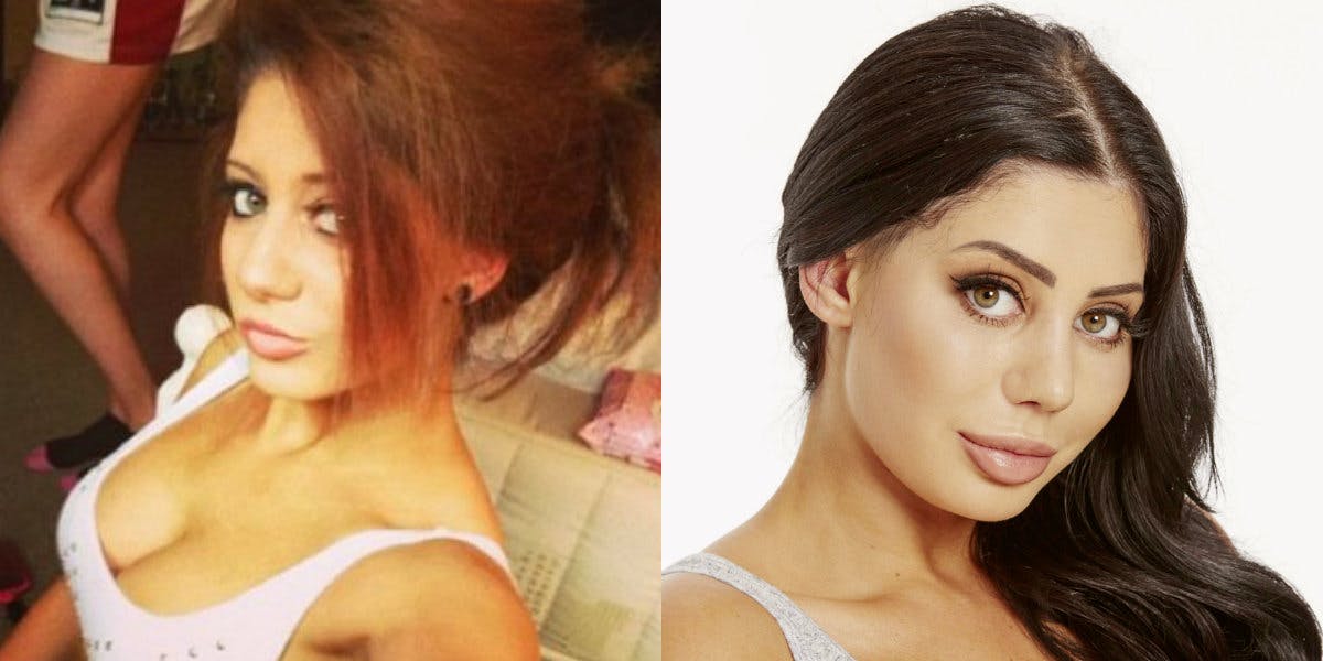 Chloe Ferry reveals the results of her nose job – and says she’s ...