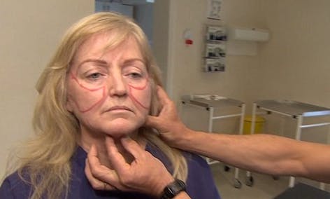 Linda Nolan: "I had a £6k facelift to fight my sadness"