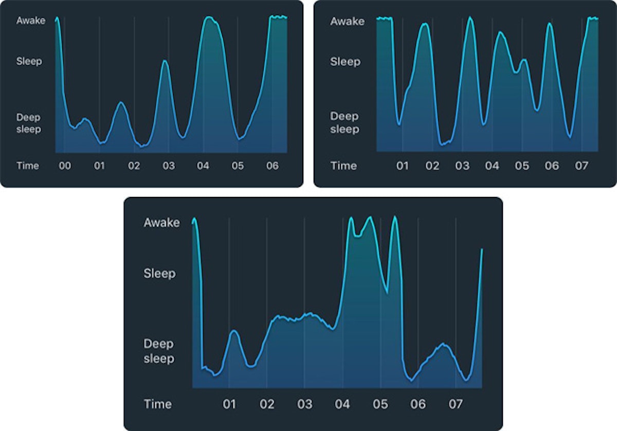 Sleep Cycle App: How It Works And The Benefits