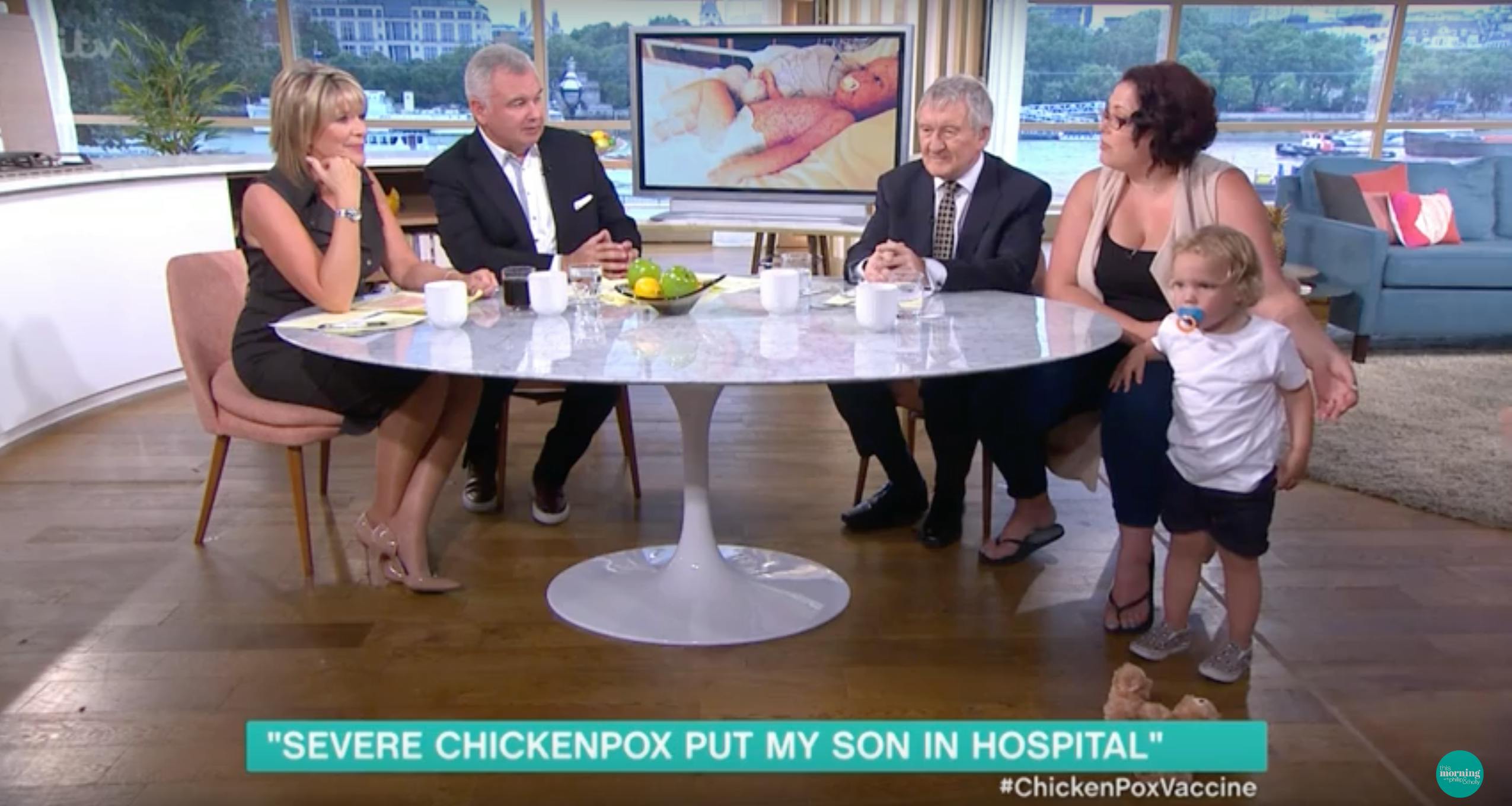 Boy suffered worst case of chickenpox EVER - Closer