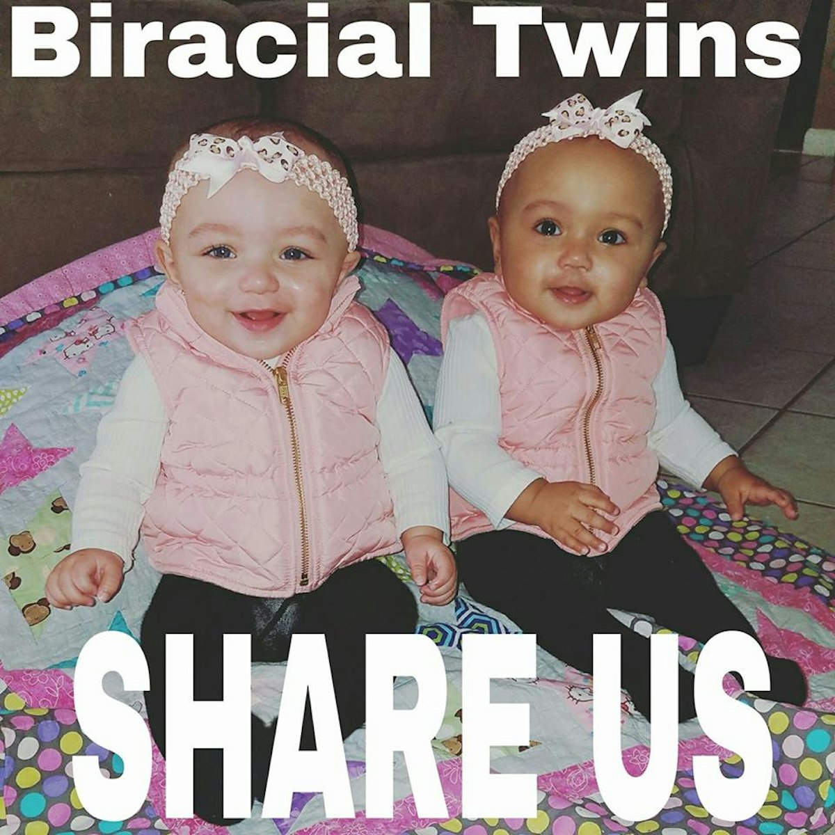 Rare biracial twin girls Kalani and Jarani are born in Illinois USA ...