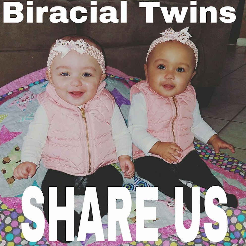 Rare biracial twin girls Kalani and Jarani are born in Illinois USA ...