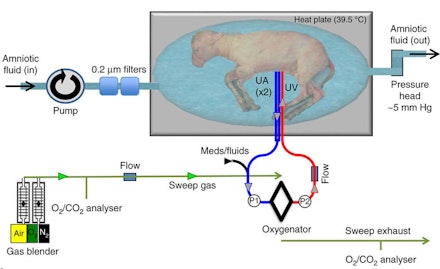 Scientists create ARTIFICIAL womb to help premature babies | Closer