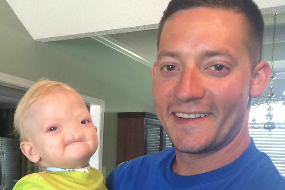 People Without Noses