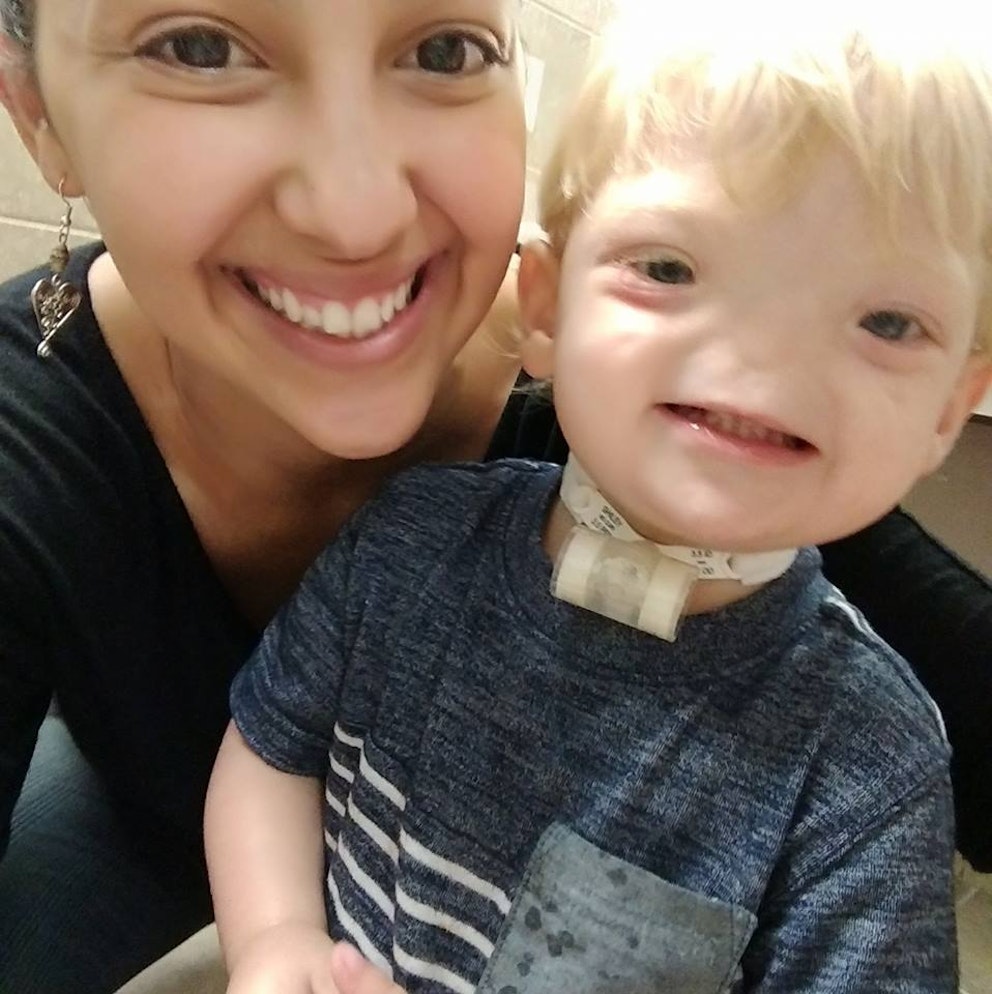 Toddler Eli Thompson born with no nose passes away at two-years-old