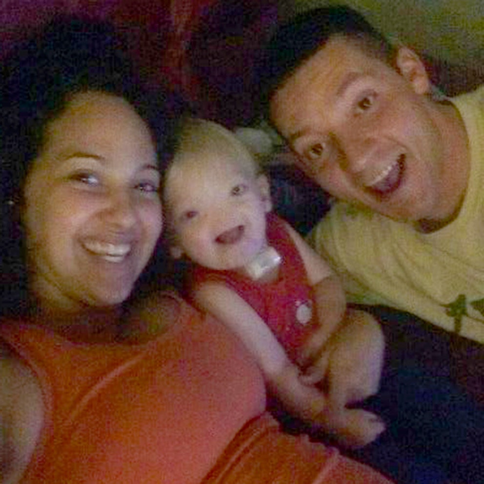 Toddler Eli Thompson born with no nose passes away at two-years-old