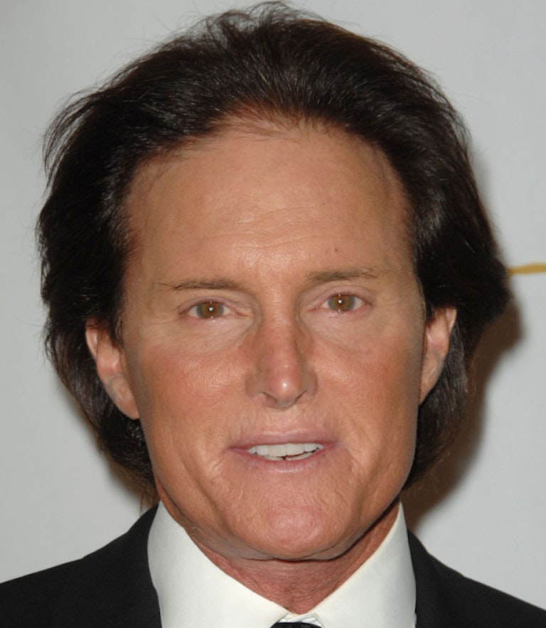 Plastic surgery timeline – the changing face of Bruce Jenner ...