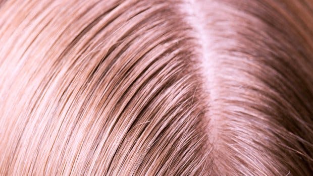 How To Cure A Dry Itchy Flakey Scalp