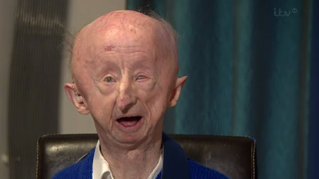 Man who mugged disabled Alan Barnes jailed for four years | Closer
