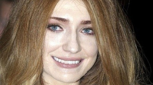 Celebrity teeth before and after! Cheryl Cole, Tulisa Contostavlos and ...