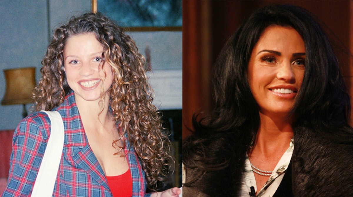 Surgery transformations: the top 10 unrecognisable celebrities ...