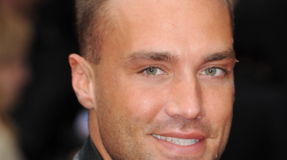 Calum Best Hair Transplant: Behind the Scenes Insight
