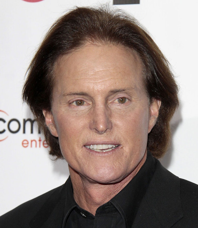 Plastic surgery timeline – the changing face of Bruce Jenner ...