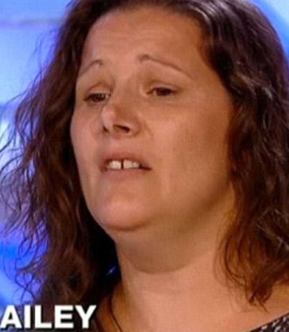 Sam Bailey speaks out about terrifying Bell’s palsy which threatened to ...