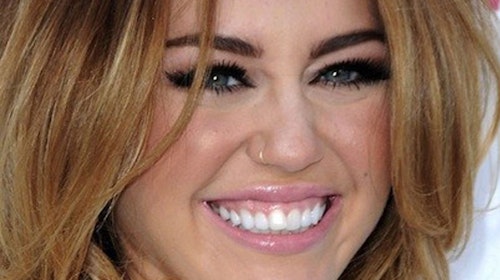Celebrity teeth before and after! Cheryl Cole, Tulisa Contostavlos and ...