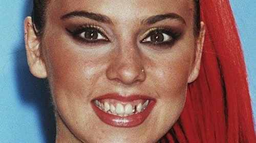 Celebrity teeth before and after! Cheryl Cole, Tulisa Contostavlos and ...